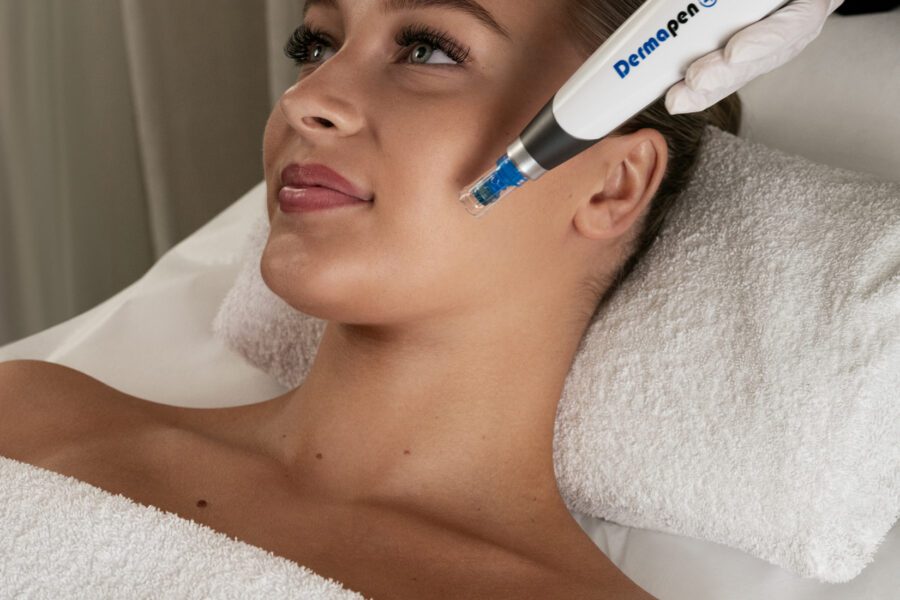 Microneedling - Akademikliniken®